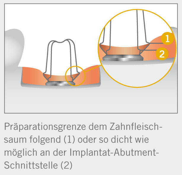 sollten sie innerhalb einer patientenversorgung unterschiedliche arten ...